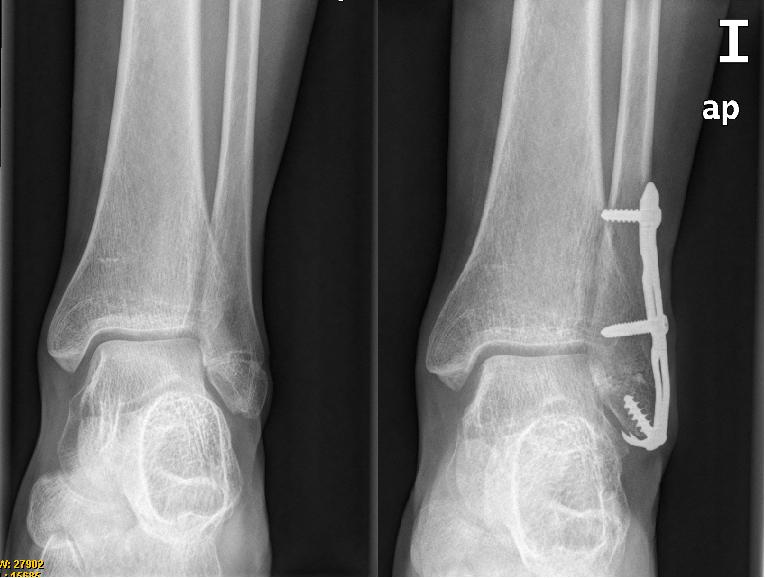 Fanáticos del pie: agosto 2013