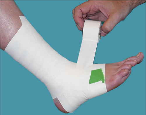 Vida hospitalaria: Tipos de vendajes