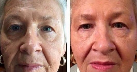 Face Workouts To Lift And Tauten Sagging Jowls And Slack Face Skin: At ...