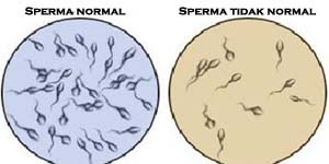 Ciri-Ciri Pria Yang Mandul ( Pria Wajib Baca ) - Klinik Rea