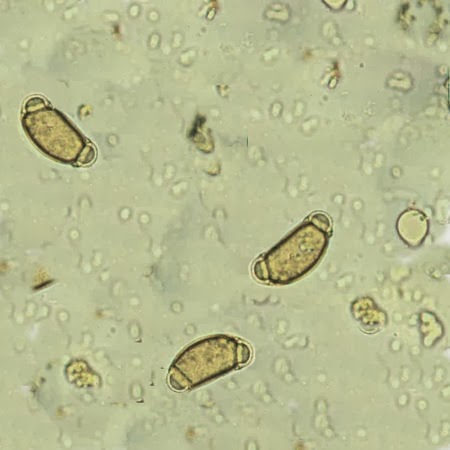 Medical Laboratory and Biomedical Science: Faecal Parasite Case