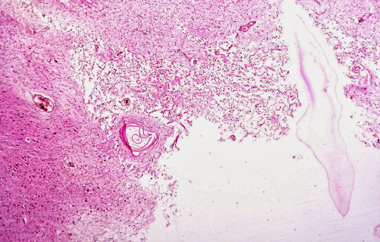 September 2013 | Pathology