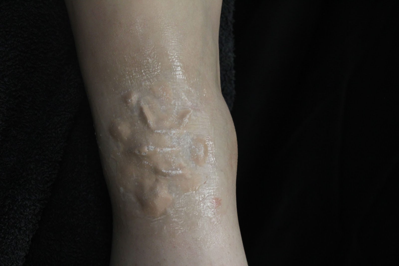 Make-up for Special Effects Unit: Brave New World: Snake Bite Wound ...