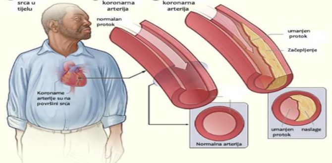 Pozdravite se sa začepljenim arterijama, visokim krvnim pritiskom i ...