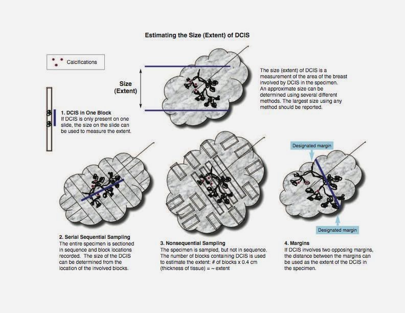 Oncopathology Update: Measuring size of DCIS