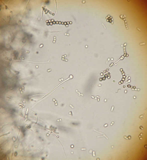 ATLAS MICOLOGIA: SCYTALIDIUM DIMIDIATUM (Neoscytalidium dimidiatum)