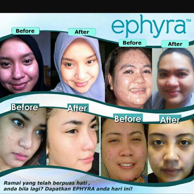 Mama Beauty : Ephyra Premium