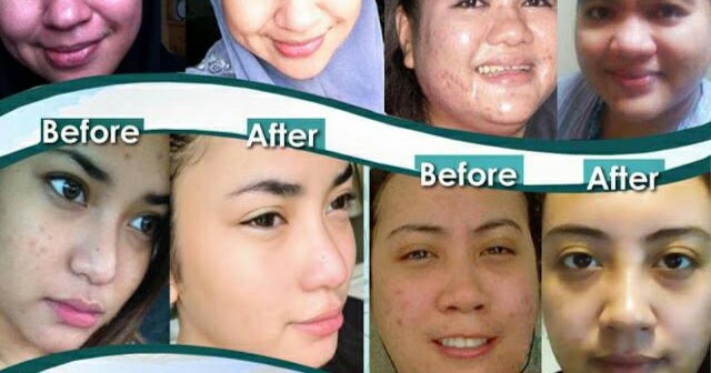 Mama Beauty : Ephyra Premium