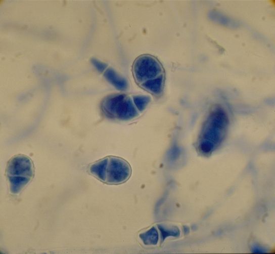 Microbiología y Epidemiología: Microsporum