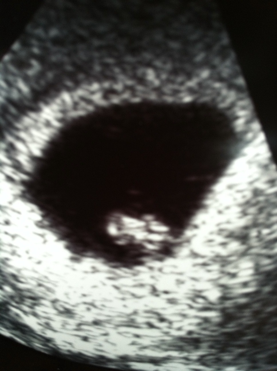 January 2012 Moms: Ultrasound Gallery