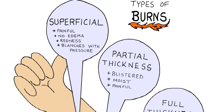 ALL FOR NURSING: MS: Burns