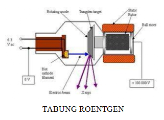 radiologi oh radiologi: Pembentukan sinar X