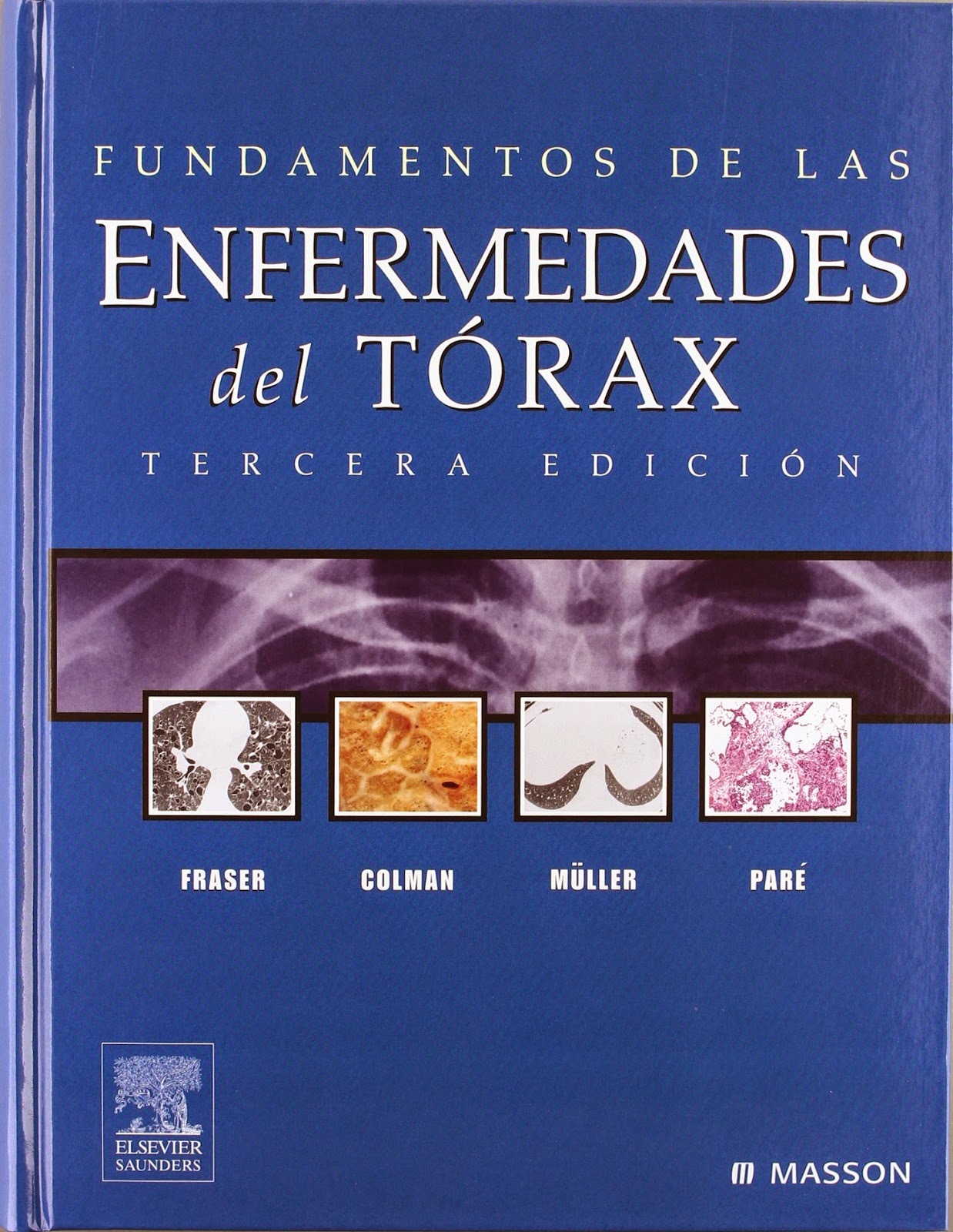 Biblioteca Médica y de la Salud: Fraser; Fundamentos de las ...