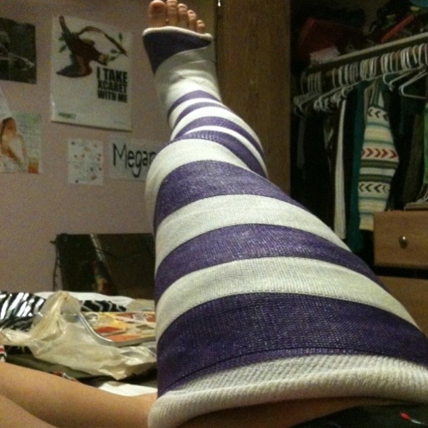 Casts and Toes: Some random Full Leg Cast finds