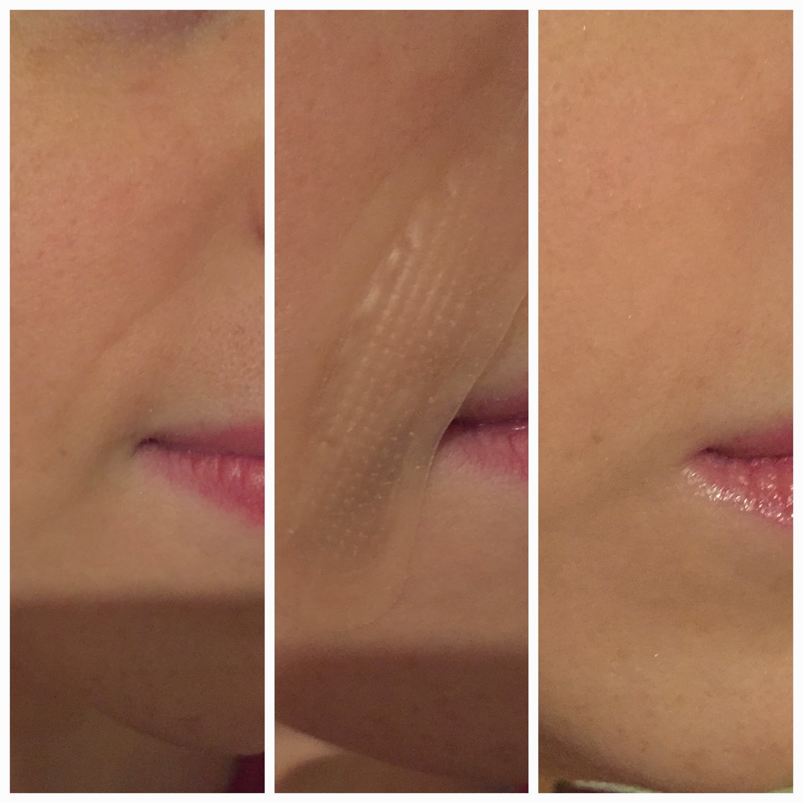 Acute Care: Acute Care Face Cream