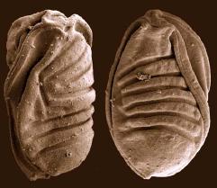 Parasite of the Day: Myxidium sp.