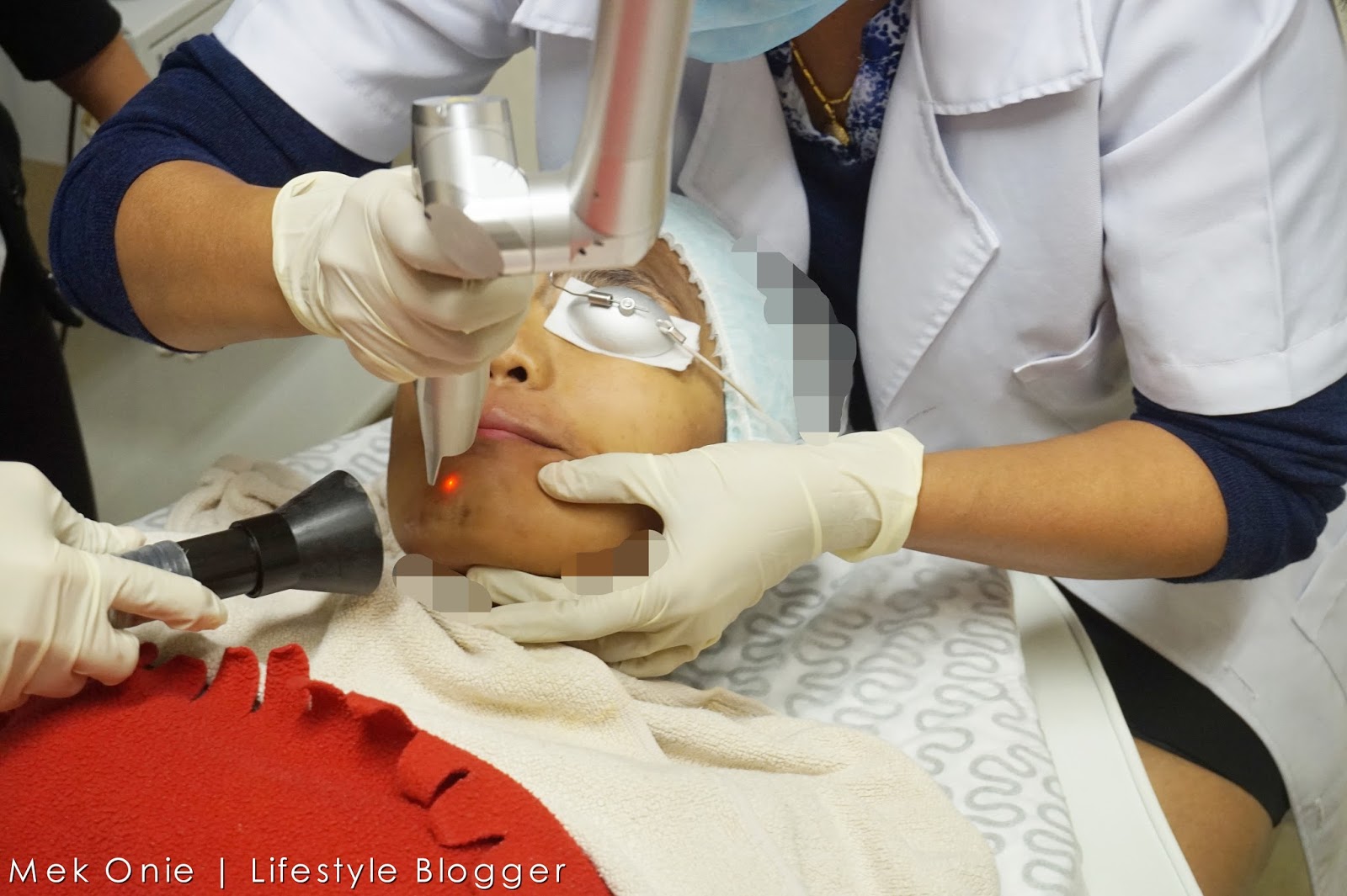 Pengalaman Laser Muka Di Premier Clinic,TTDI - Mek Onie