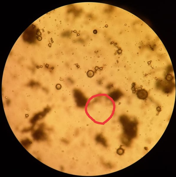 BENDA ERGASTIK ALEURON PADA TUMBUHAN