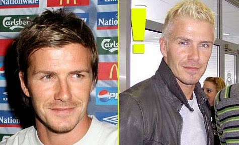 David Beckham Plastic Surgery Before and After Botox Injections Photos ...