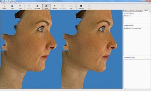 Welcome to Take Shape Plastic Surgery's Blog: Take Shape Plastic ...