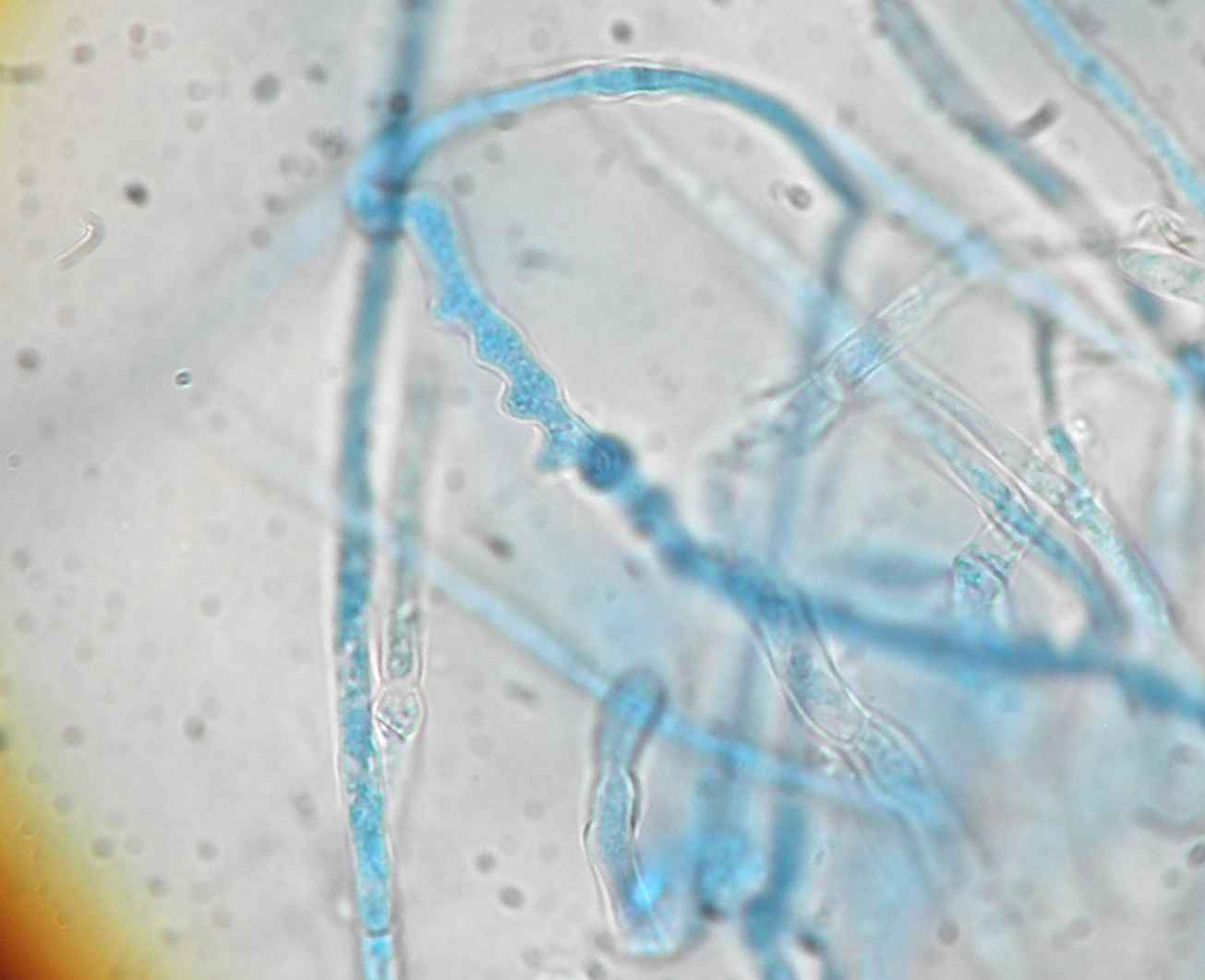 ATLAS MICOLOGIA: MICROSPORUM AUDOUINII