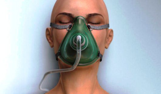 Blog da Fisiocursos Manaus: A Ventilação Mecânica Não Invasiva (VNI)