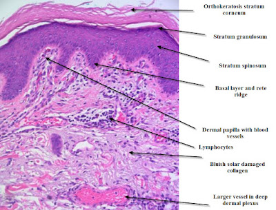 Dermatopathology Made Simple - Inflammatory: Introduction to skin ...