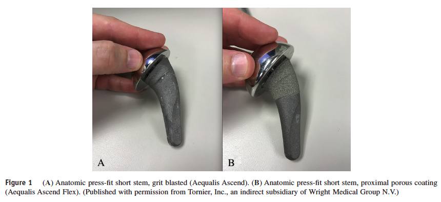 Shoulder Arthritis / Rotator Cuff Tears / Shoulder Pain : Short humeral ...