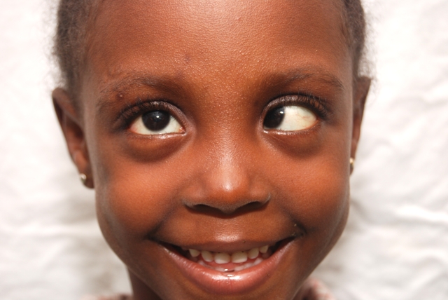 DEBRA BELL MERCY IN WEST AFRICA: SIERRA LEONE- Atamin Avon-Crossed Eyes