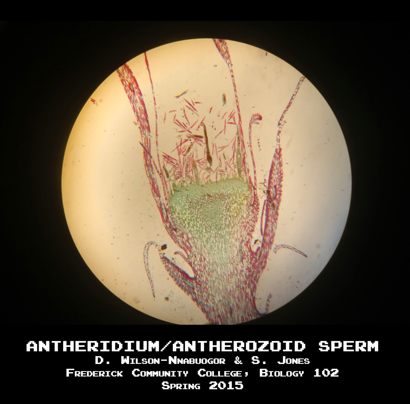 The Bio Inq.: Antheridium bearing antherozoid sperm [ o~ o~ ]