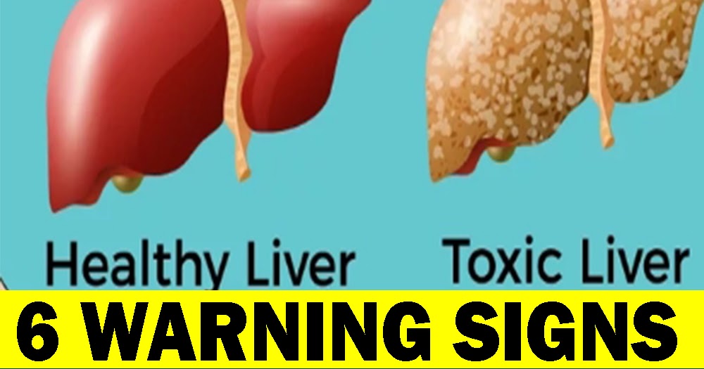 6 Clear Warning Signs Your Liver Is Full Of Toxins And Making You Fat ...