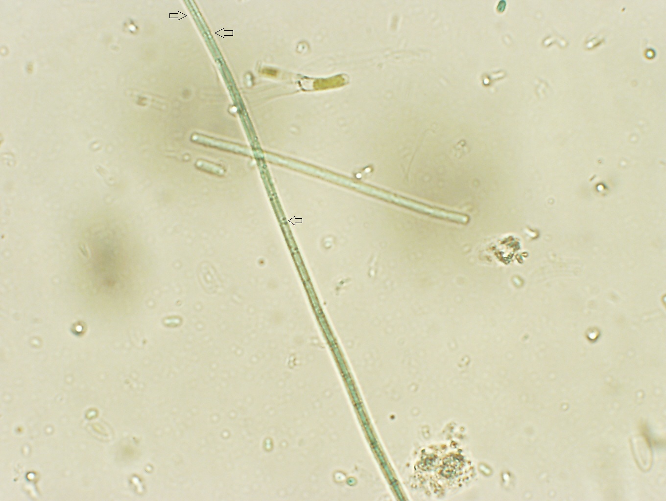 Two Years and Three Months of Cyanobacteria: Chapter XVI. Retraction of ...