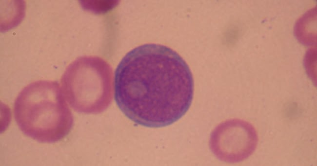 Fichero de Hematologia: Proeritroblasto