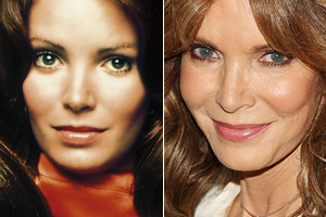 Jaclyn Smith Plastic Surgery