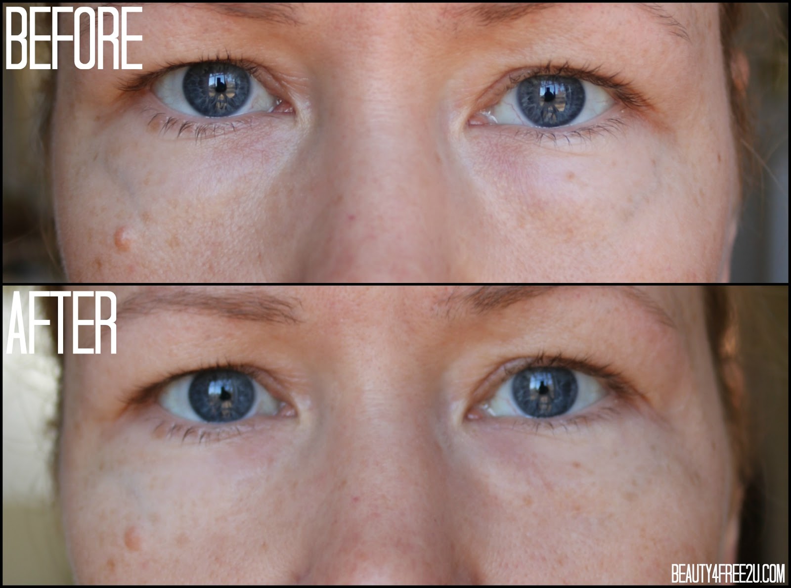 Instantly Ageless: the best instant wrinkle filler for the under-eye area?