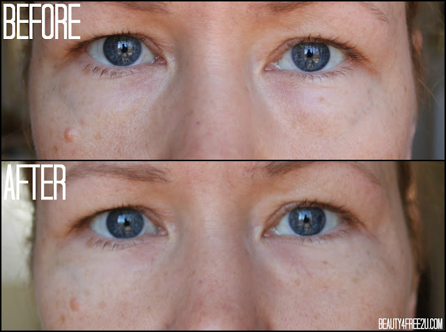 Instantly Ageless: the best instant wrinkle filler for the under-eye area?