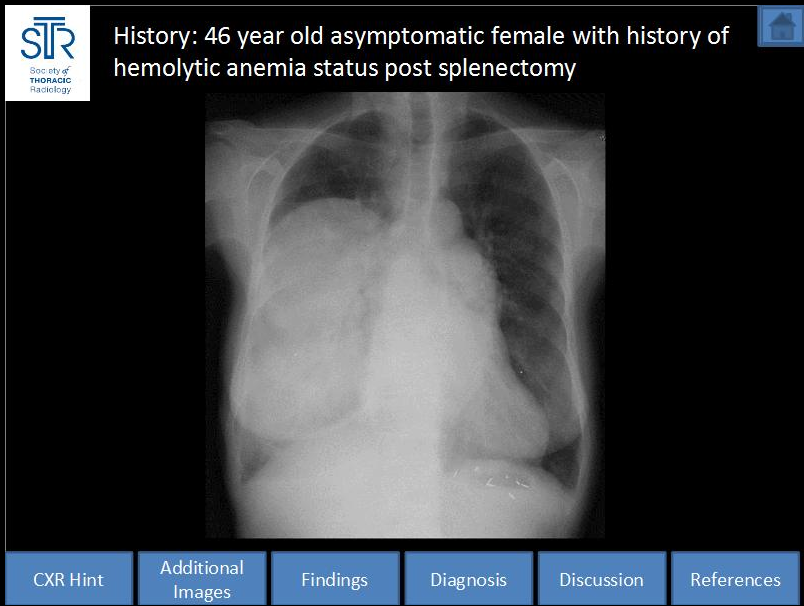 Radiologia en Internet: abril 2014