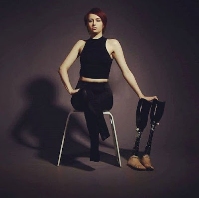 Model whose legs were amputated shows off beauty of her 'new body ...