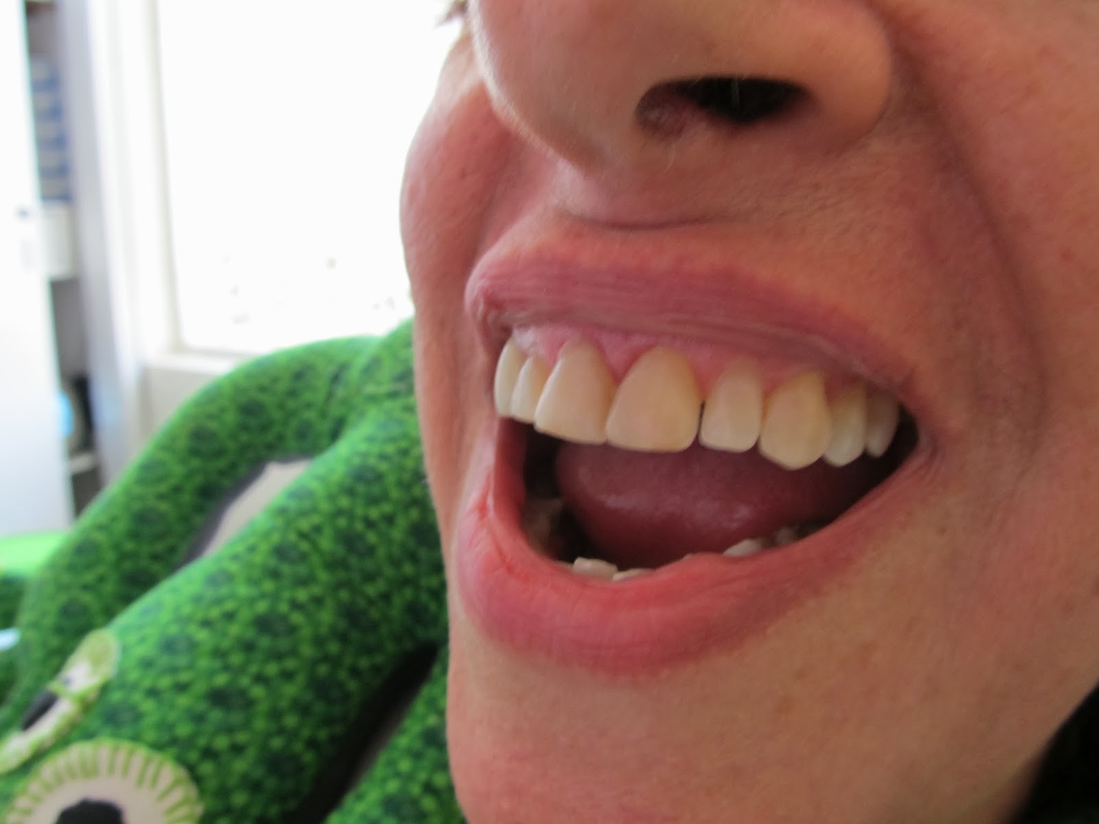 Odontología Estética Integrada Odontesin: octubre 2013