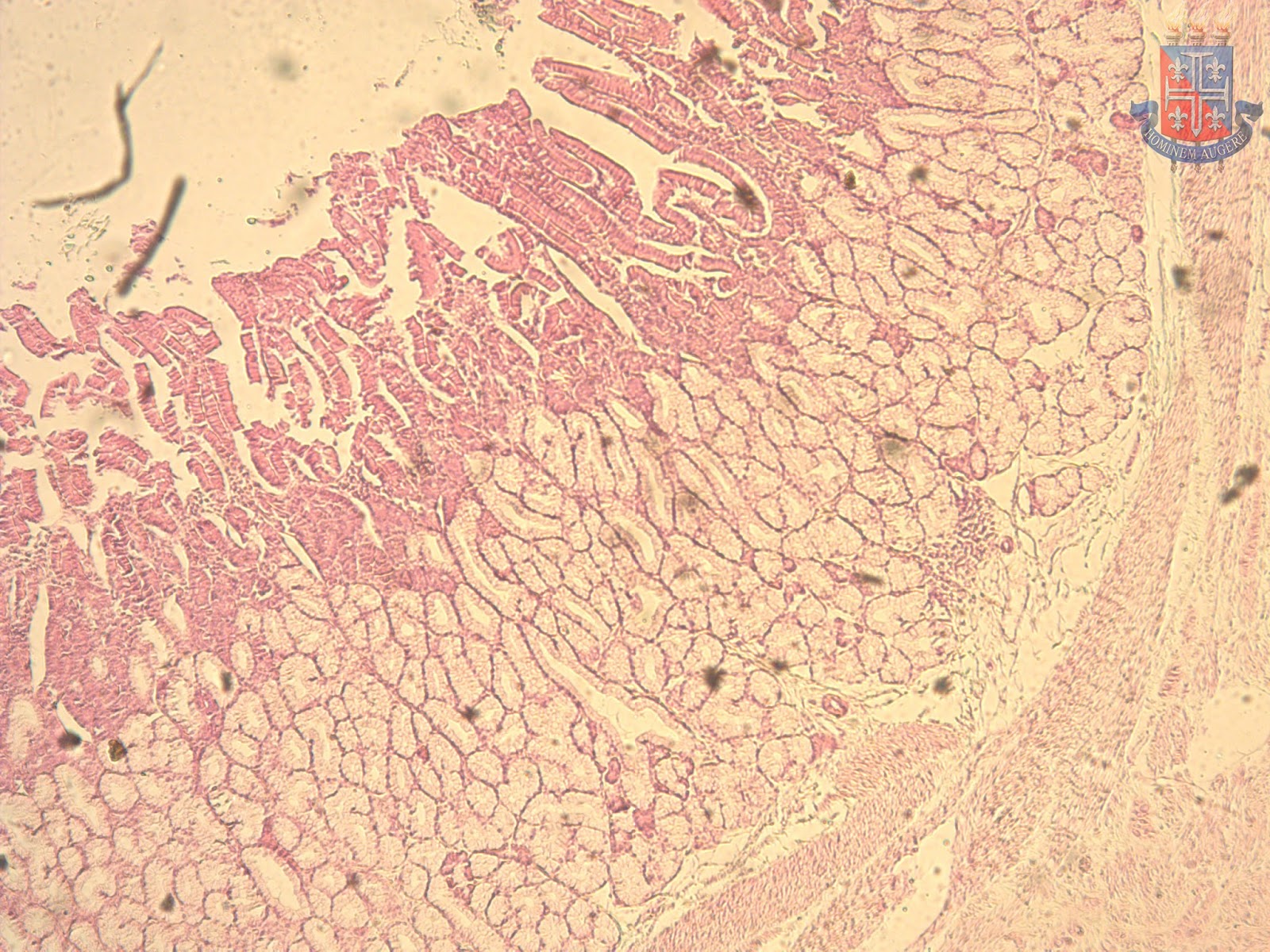 Atlas virtual de histologia e patologia: Duodeno