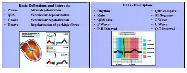 What is ECG (electrocardiography) and how does it work?
