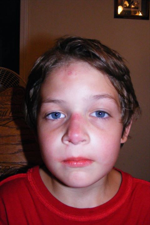 Diaperheads: Face Plant