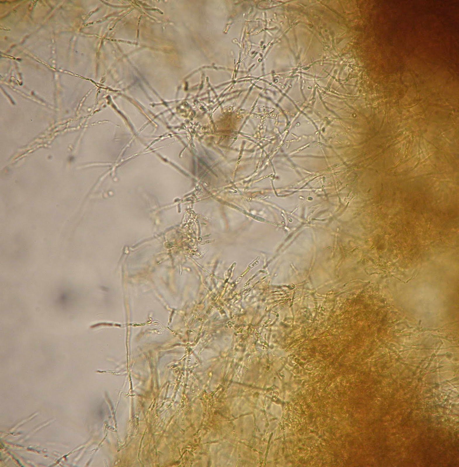 ATLAS MICOLOGIA: TRICHOPHYTON SOUDANENSE