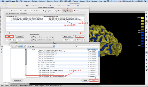 Neuroimaging Made Easy : Brainvoyager QX tips and tricks 1; Some ...