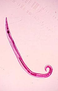 (DOCX) Cacing kremi ENTEROBIUS VERMICULARIS - DOKUMEN.TIPS