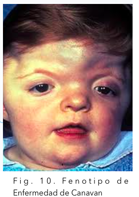 RED LATINOAMERICANA DE PEDIATRÍA Y NEONATOLOGÍA: Malformaciones ...