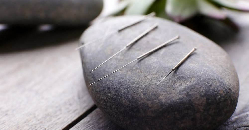 Terapi Meridian Magnet - Terapi Jarum