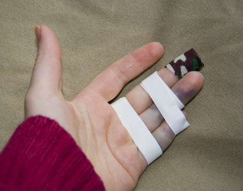 All Works in Progress: A new skill - Buddy Taping!