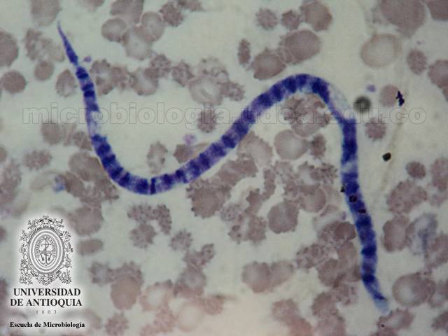 Lecture Notes in Medical Technology: Lecture #3: THE BLOOD and TISSUE ...