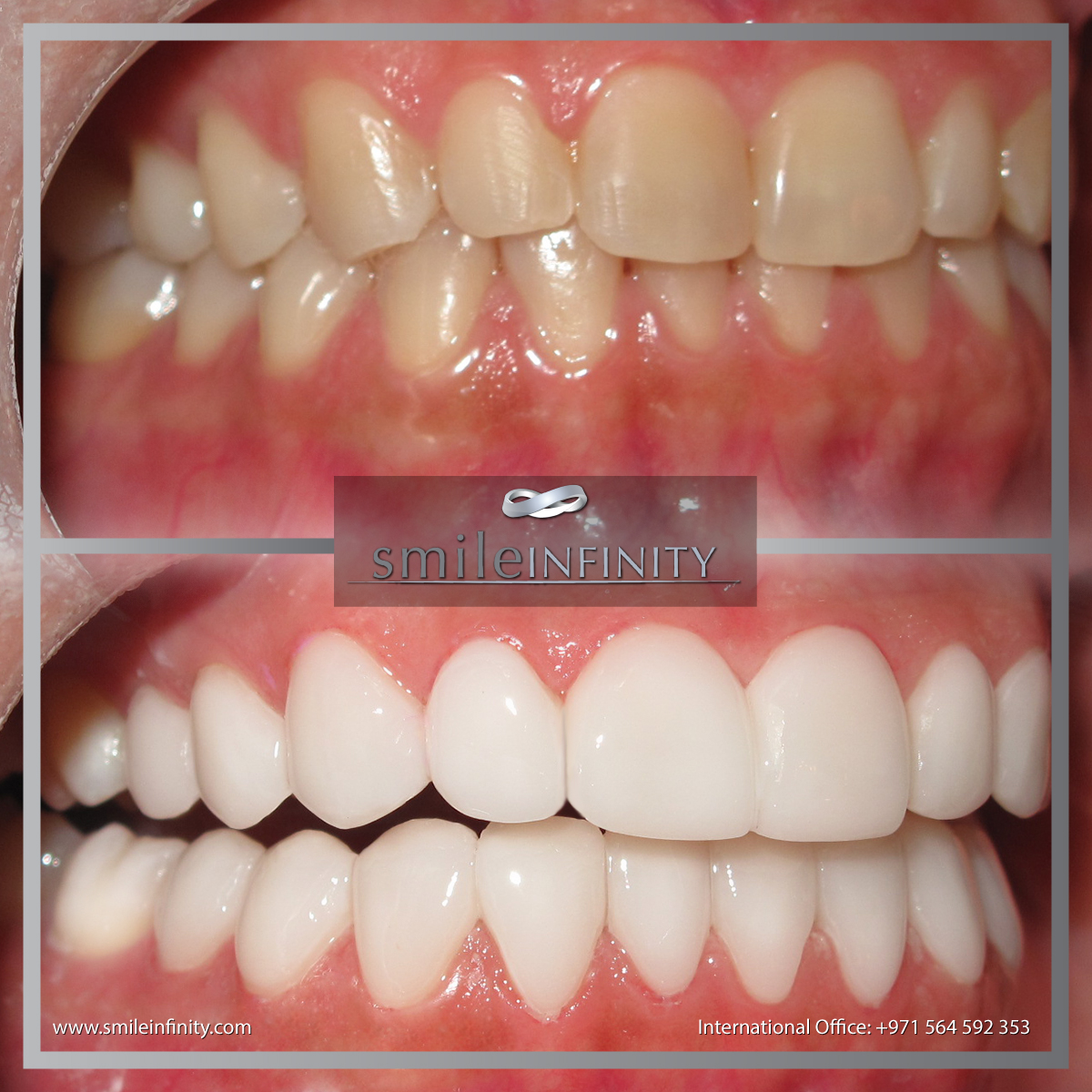 Hollywood Smile Lebanon Elite dentists at CMC Hospital affiliated with ...